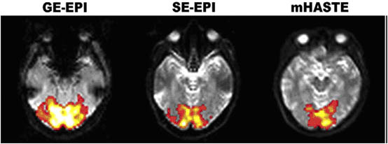 IBP Researchers Develops Alternative Method for BOLD fMRI----Chinese ...