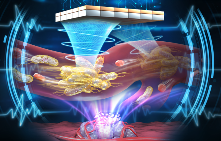 Scientists Develop New Technology for Targeted Cancer Therapy | Mirage News